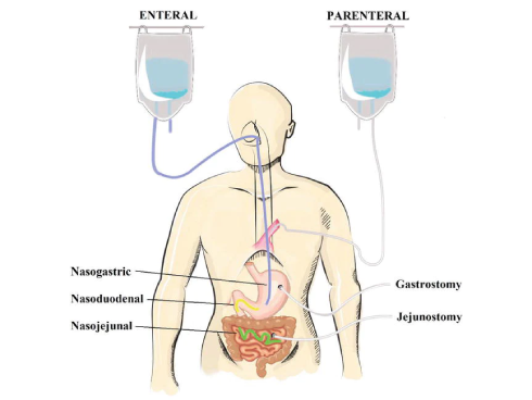 Enteral Nutrition and Parenteral Nutrition Slide Sets