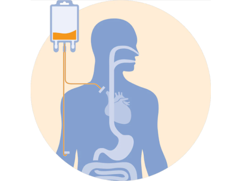 Parenteral Nutrition Slide Set